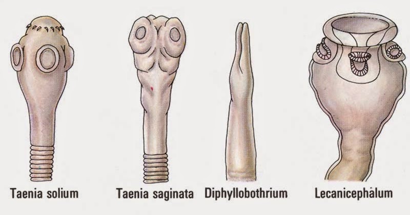 Katheryne Mesa Aponte: TENIA SOLIUM Y TENIA SAGINATA